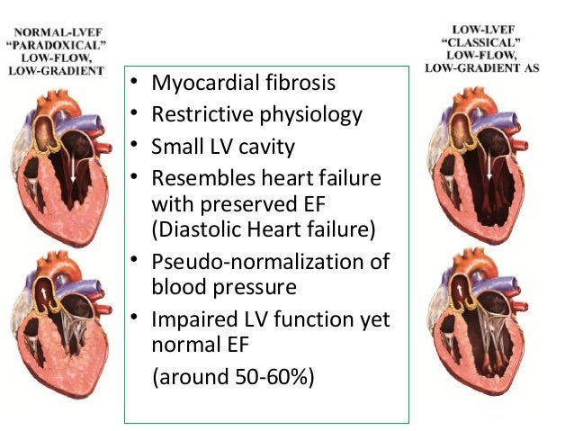 Does Preserved Lv Function Mean Heart Failure | semashow.com