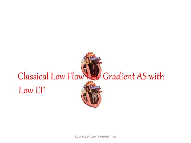 Low flow low gradient aortic stenosis | PPTX