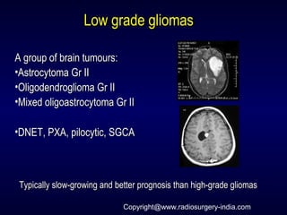 Low Grade Glioma | PPT