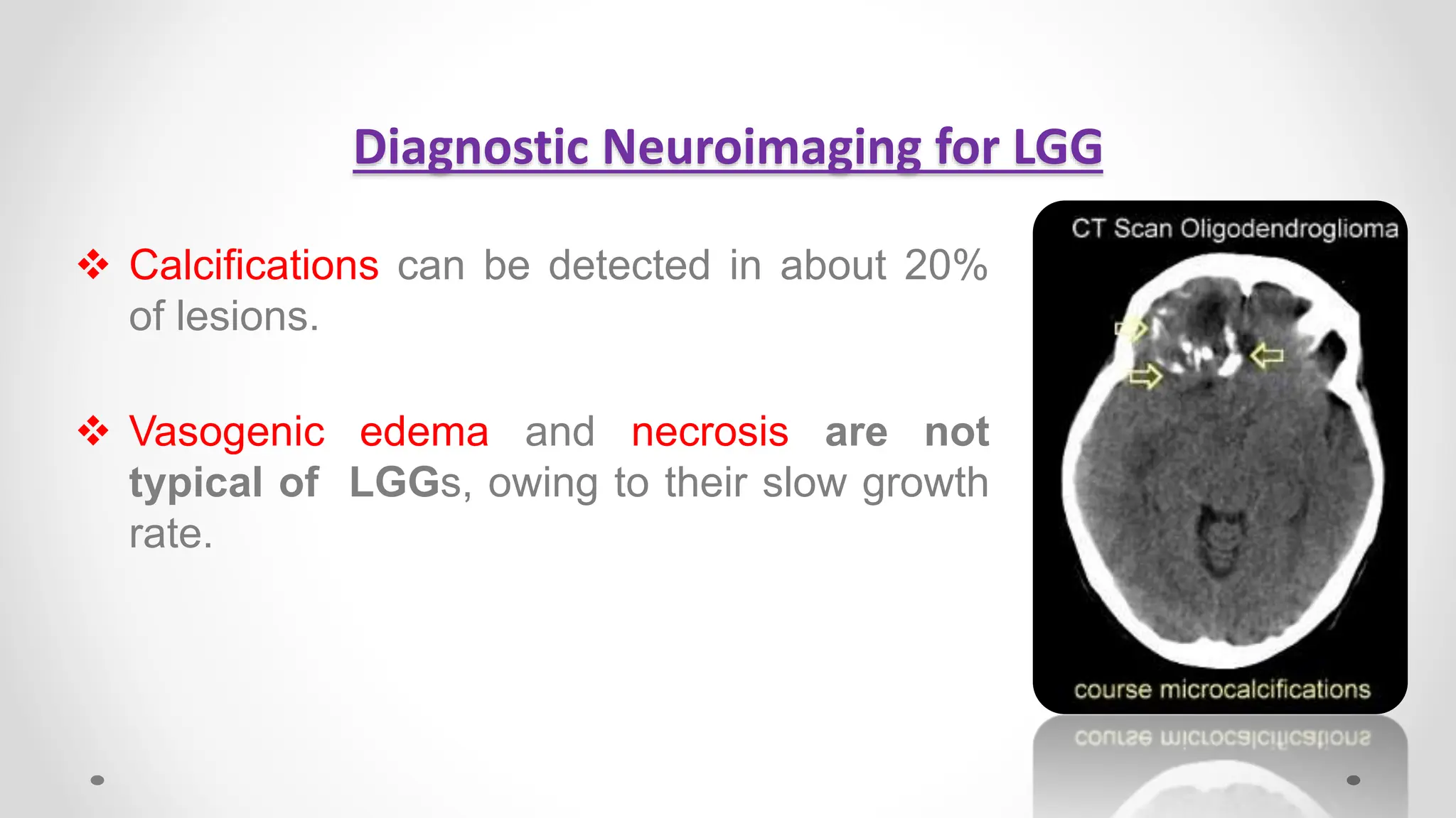 LOW GRADE GLIOMA.pptx