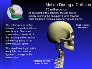 Low Speed Rear End Collisions | PPT