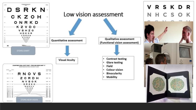 LOW VISION AIDS | PPTX | Eye and Vision Conditions | Diseases and ...