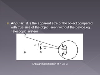 Low vision aids magnification | PPTX