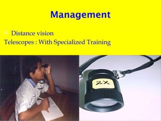 low vision intro and definitions, this PPT comprises, basic definitions ...