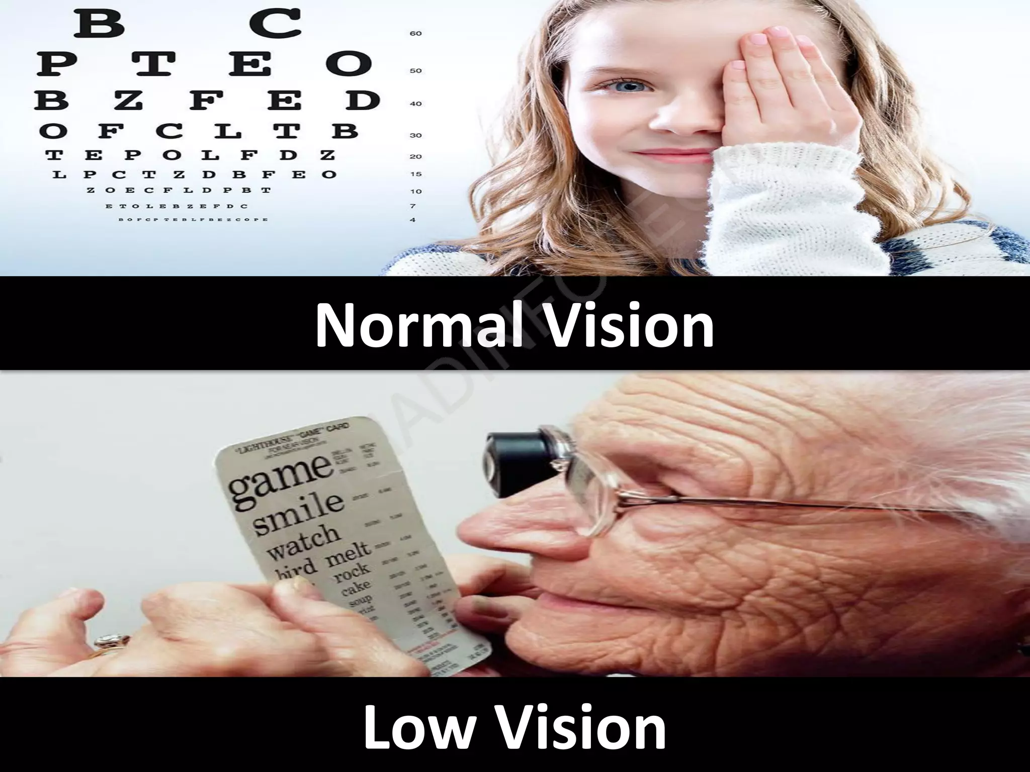 WHAT IS LOW VISION | LOW VISION INSTRUMENTS | LOW VISION SYMPTOMS ...