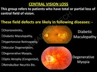 WHAT IS LOW VISION | LOW VISION INSTRUMENTS | LOW VISION SYMPTOMS ...