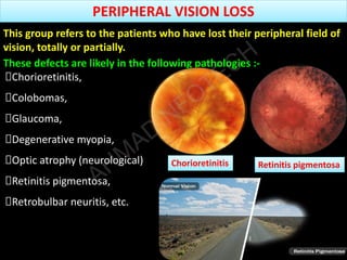 WHAT IS LOW VISION | LOW VISION INSTRUMENTS | LOW VISION SYMPTOMS ...