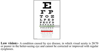 Low vision Aids | PDF