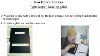 Low vision Aids | PDF