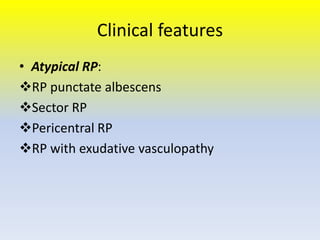 Low vision case Study Of Retintis Pigmentosa | PPTX