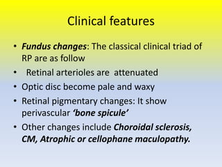 Low vision case Study Of Retintis Pigmentosa | PPTX