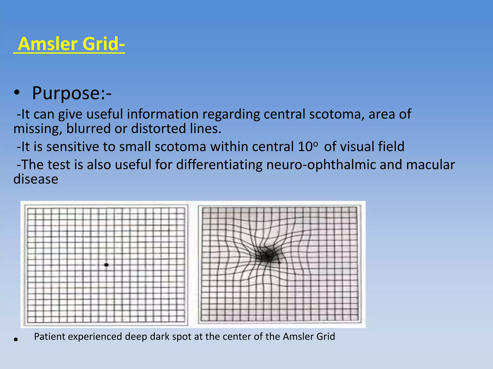 Low vision workup in ARMD | PPTX | Eye and Vision Conditions | Diseases ...