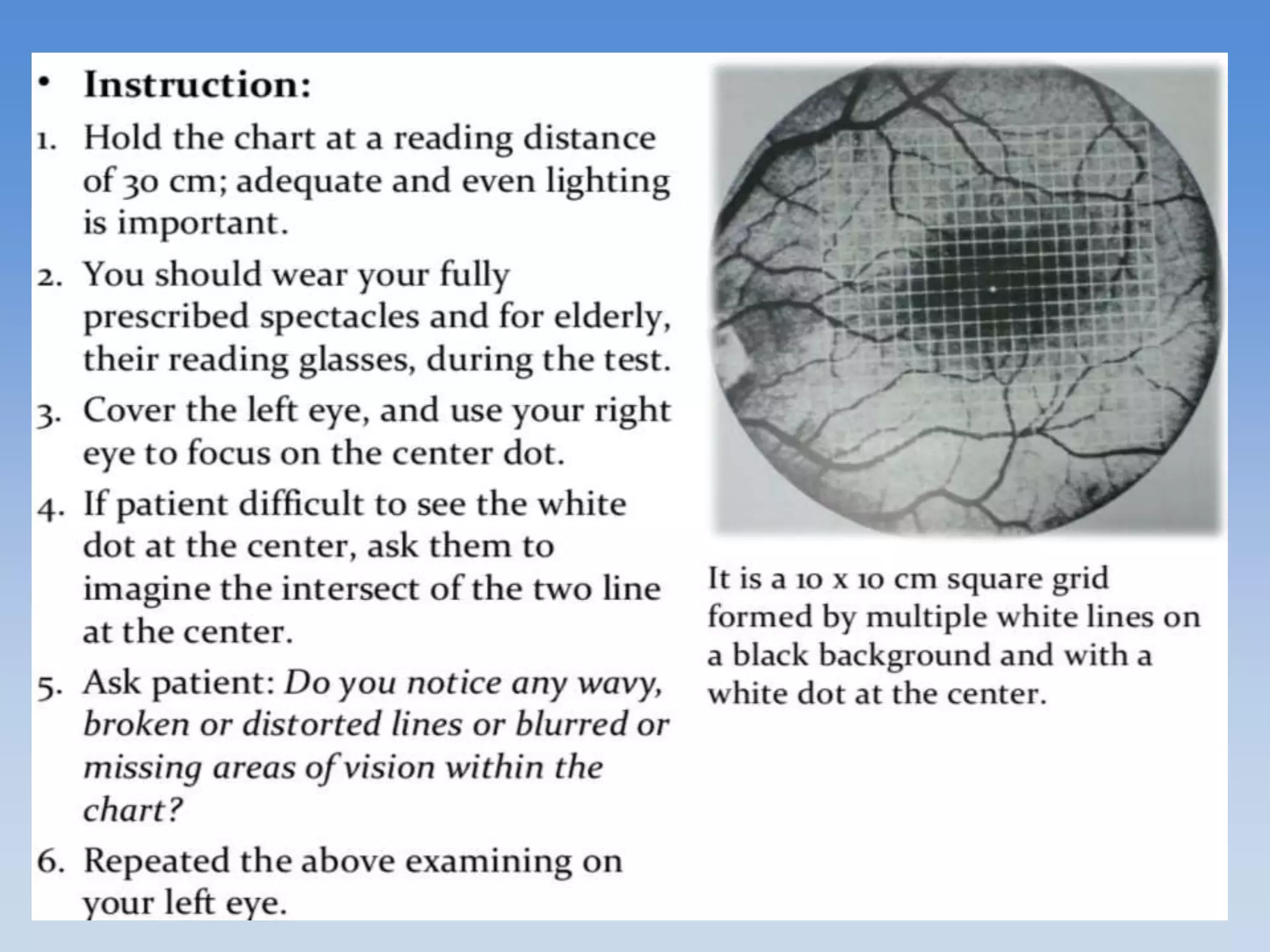 Low vision workup in ARMD | PPTX | Eye and Vision Conditions | Diseases and Conditions