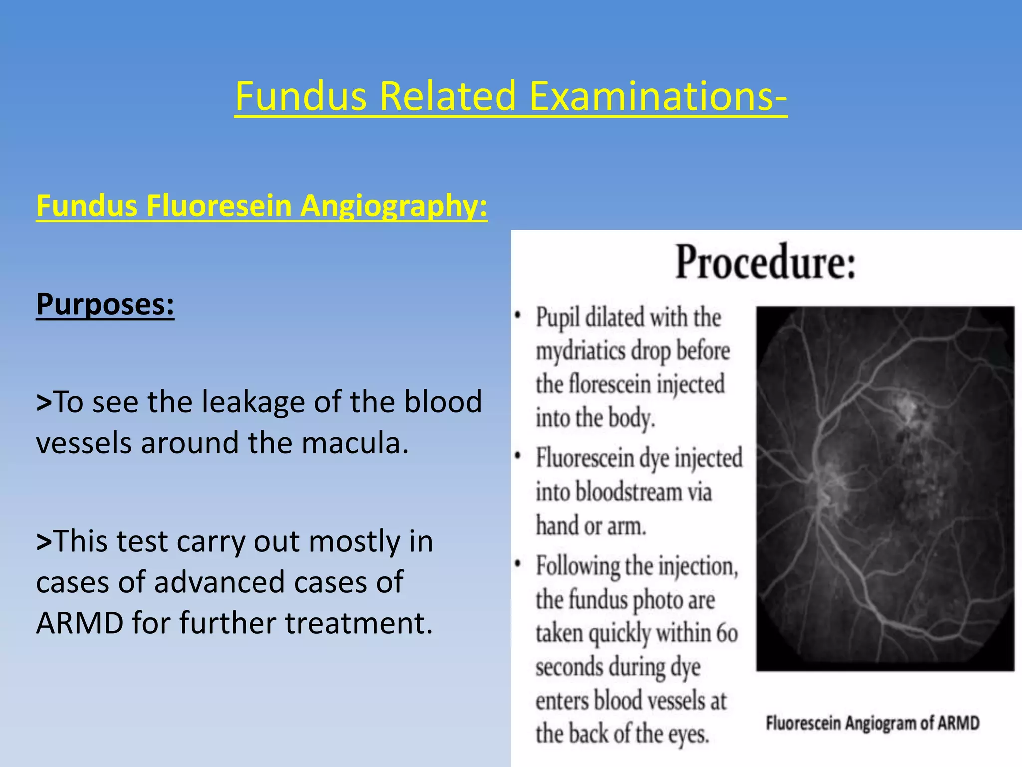 Low vision workup in ARMD | PPTX | Eye and Vision Conditions | Diseases ...