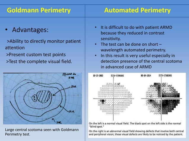 Low vision workup in ARMD | PPTX | Eye and Vision Conditions | Diseases ...