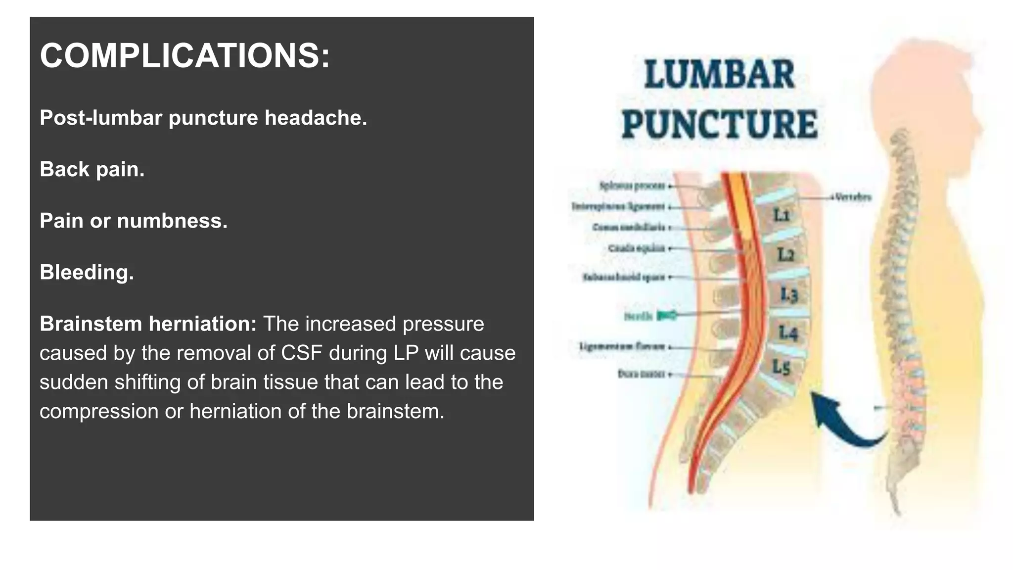 Lumber Puncture | PDF