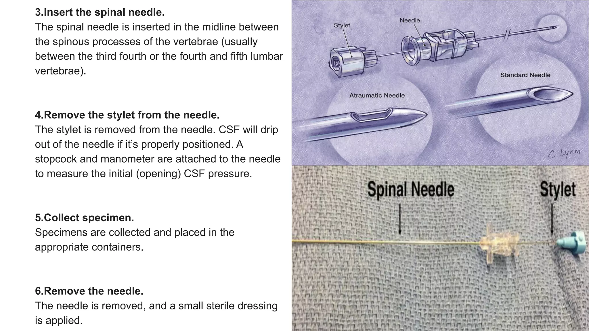 Lumber Puncture | PDF