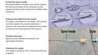 Lumber Puncture | PPT