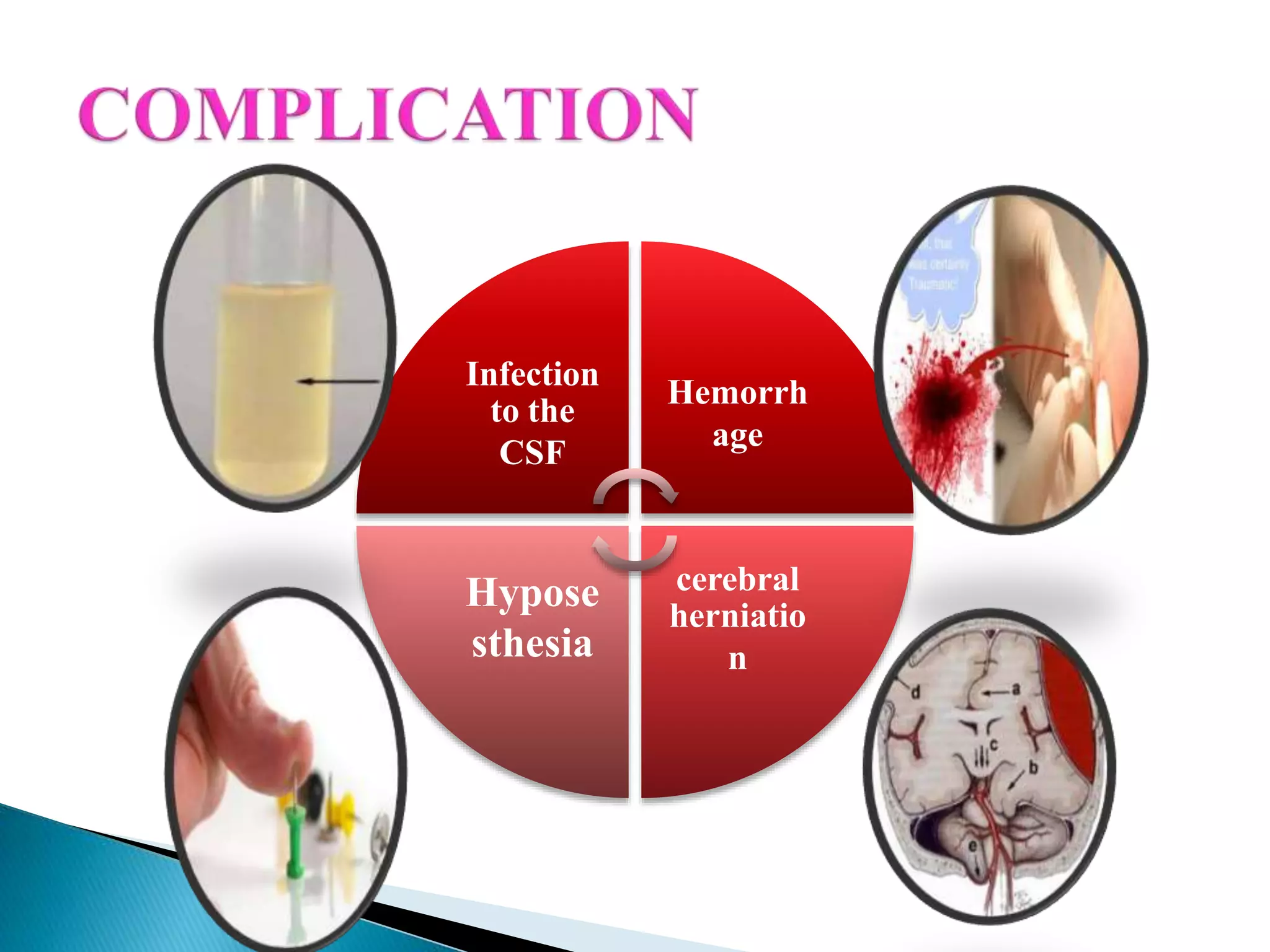 LUMBAR PUNCTURE | PPTX