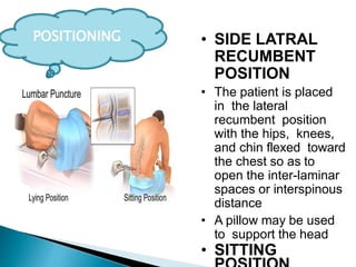 LUMBAR PUNCTURE | PPTX