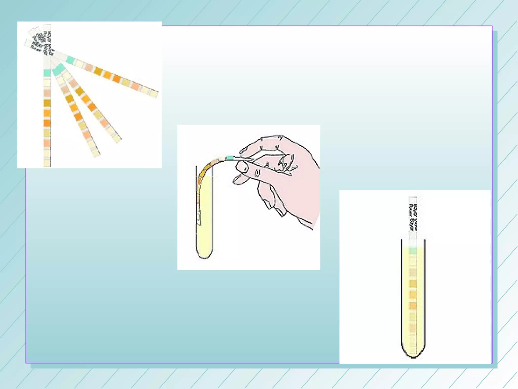 Lp 16 urinary system & urinalysis 2008 | PPT