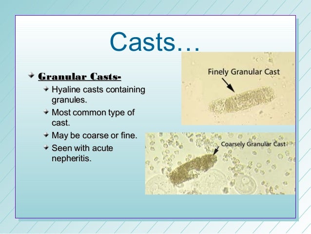 Lp 16 urinary system & urinalysis 2008
