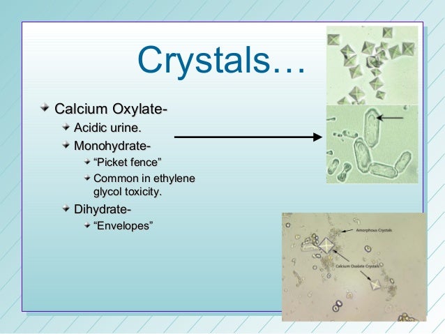 Lp 16 urinary system & urinalysis 2008