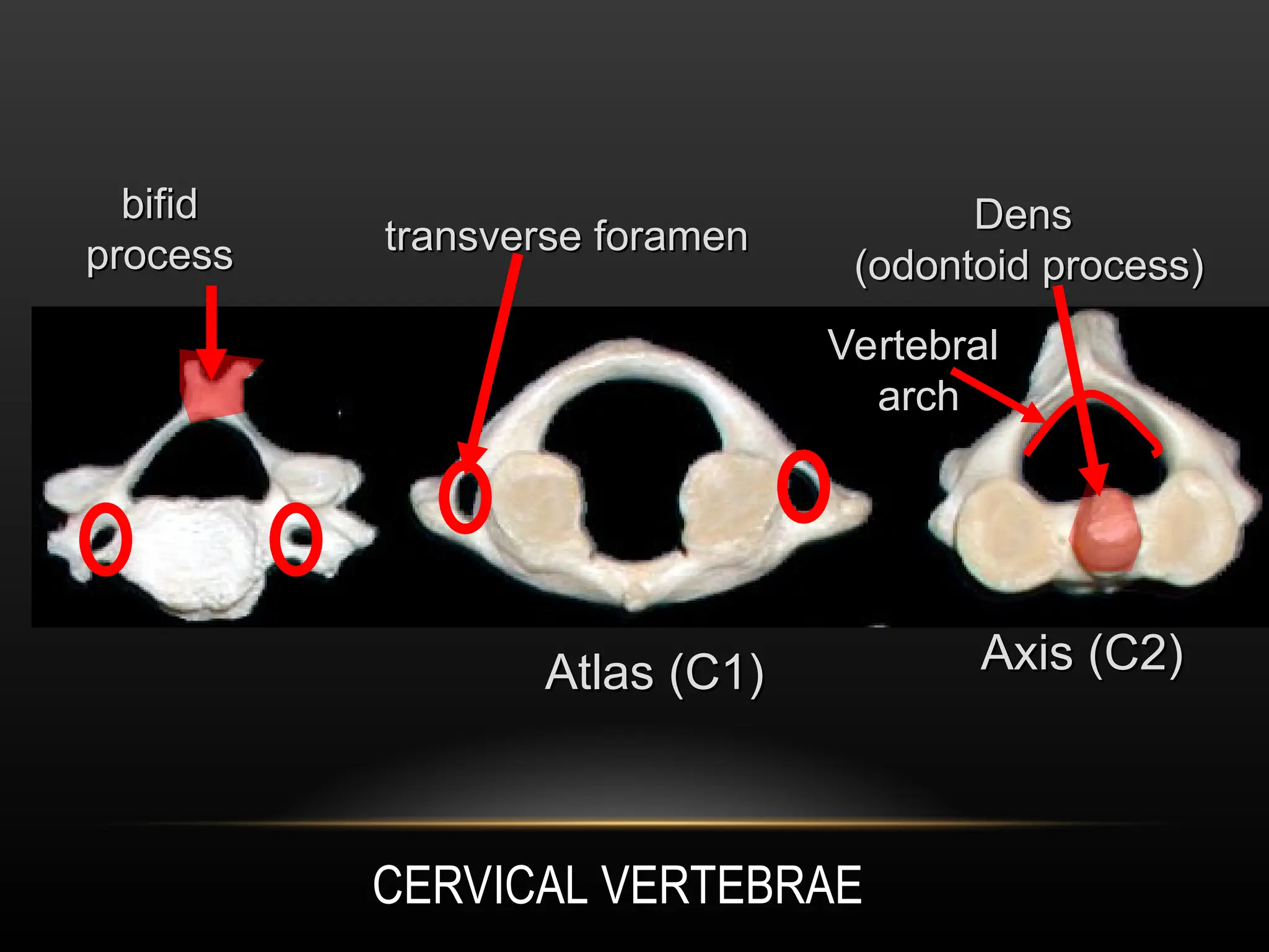 Bonesvertebral_column_and_thoraxhuman .ppt
