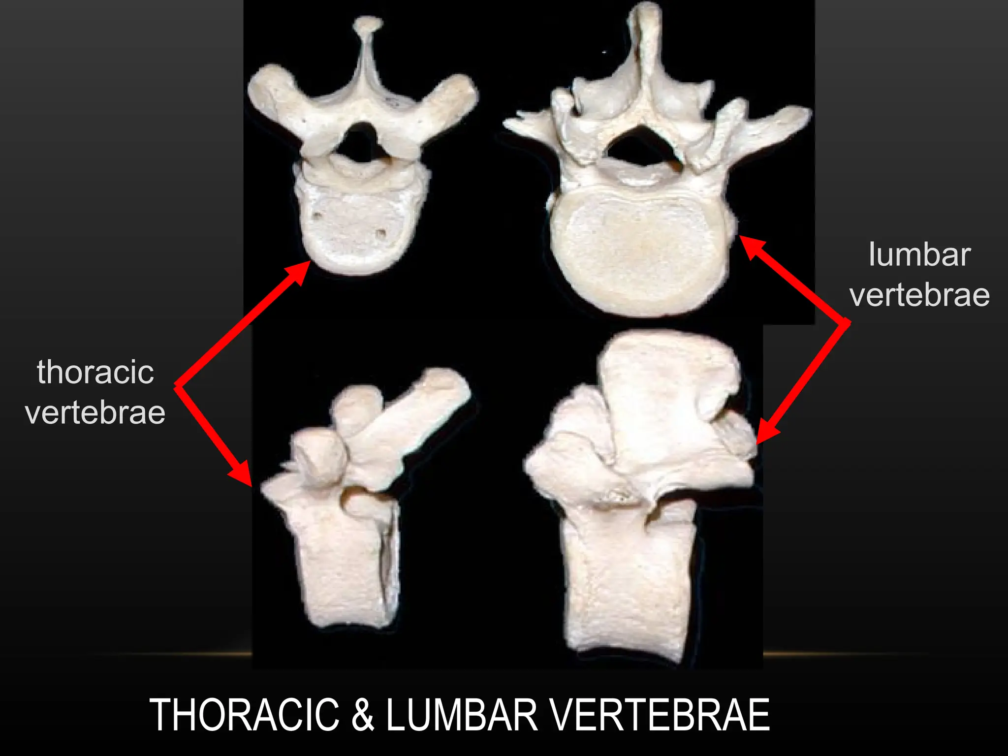 Bonesvertebral_column_and_thoraxhuman .ppt