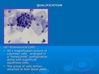 Lp atlas 0412 | PPT