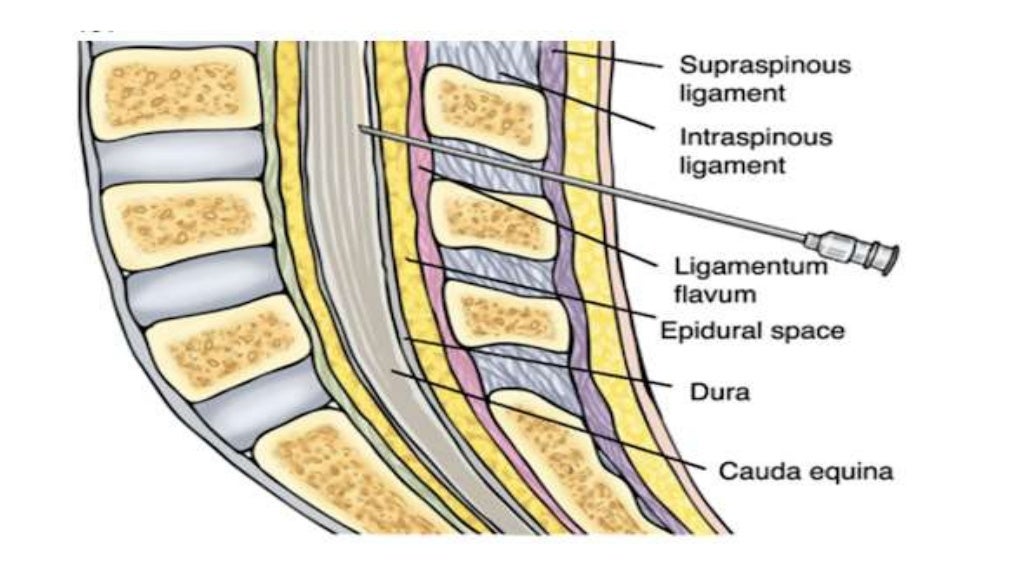 Lumbar puncture and CSF Analysis