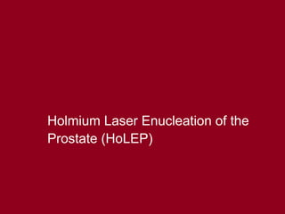 Labdabīga prostatas hiperplāzija. HoLEP | PPT
