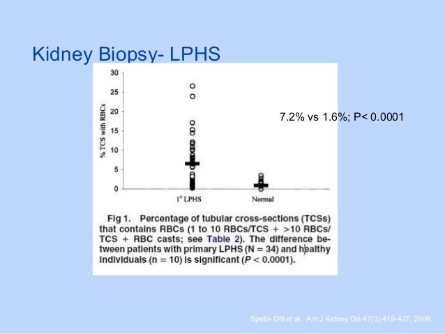 Loin Pain Hematuria Syndrome