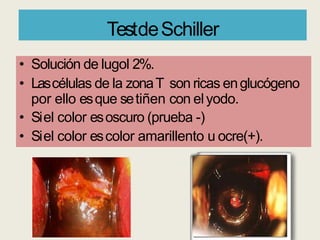 Lesiones Premalignas del Cérvix | PPTX