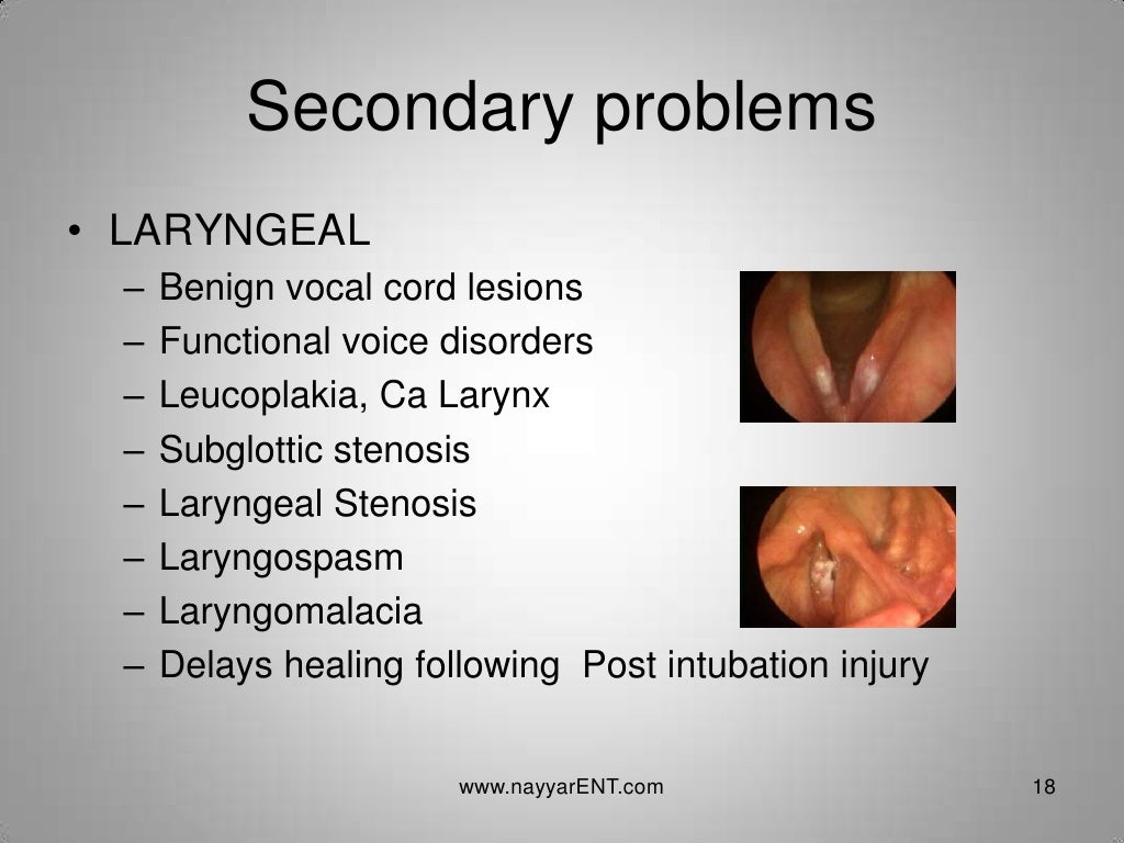 LPR Laryngopharyngeal Reflux