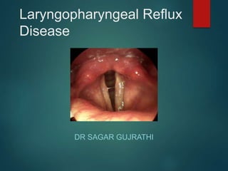 Laryngopharyngeal reflux disease (LPRD) by Dr Sagar Gujrathi.ppt