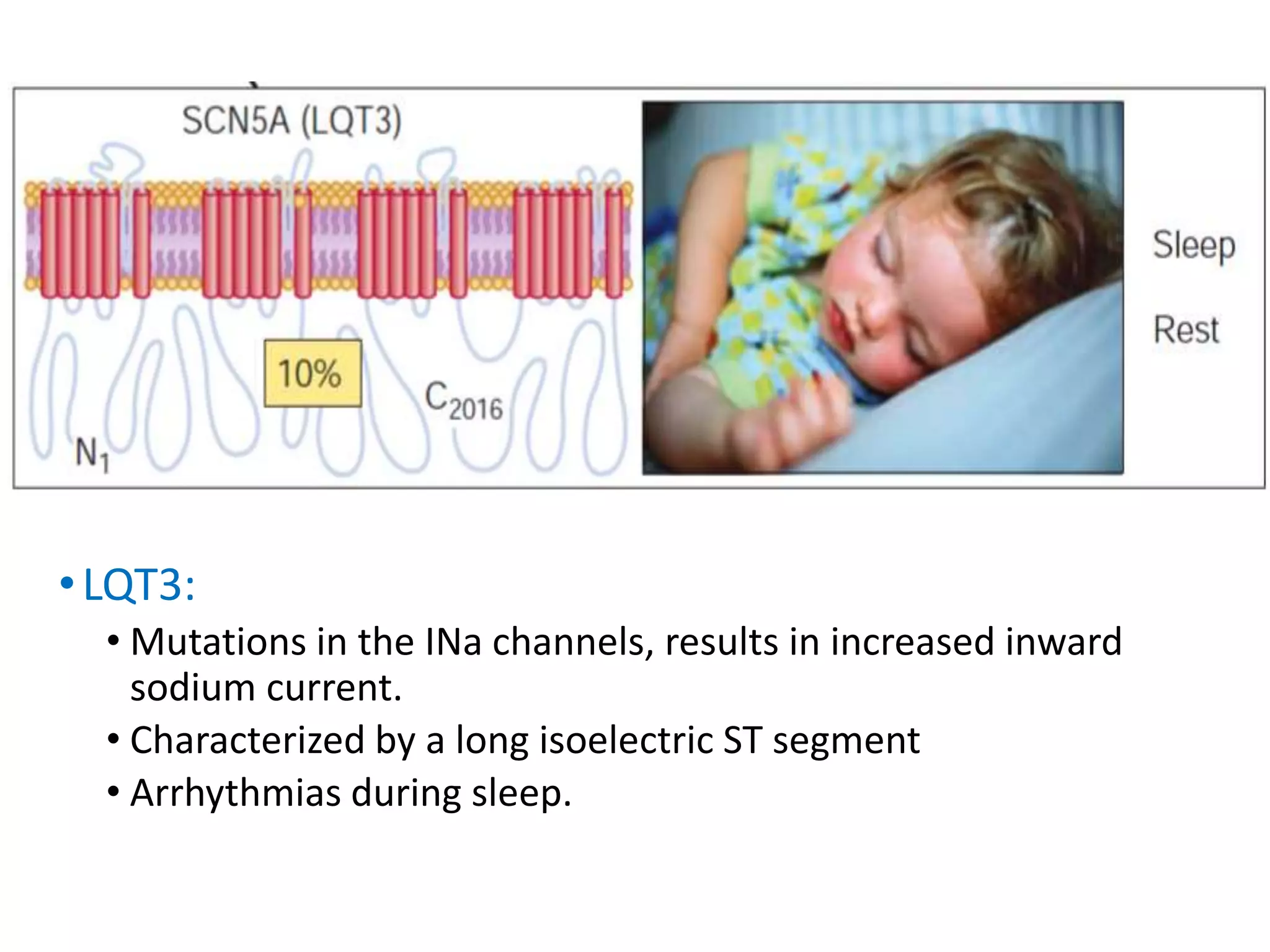 Long QT Syndrome | PPTX