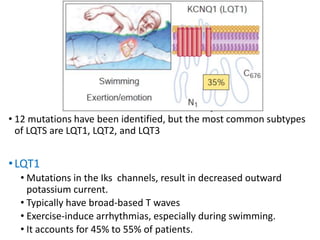 Long QT Syndrome | PPTX