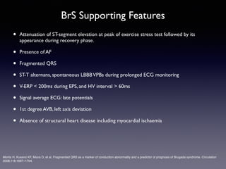 Brugada Syndrome and LQTS - the evidence | PDF