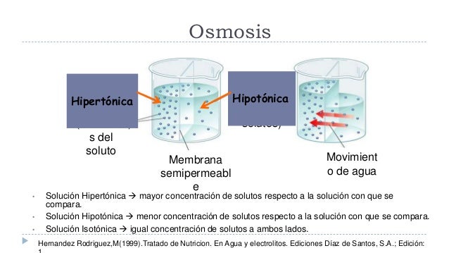 Soluciones Hipertonicas