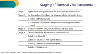 External Cholesteatoma in the ear literature reading | PPTX