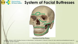 LR - TRAUMA OF MAXILLARY SINUSSSSSS.pptx