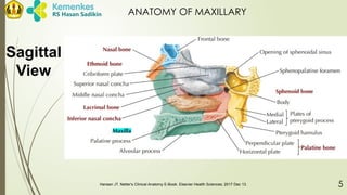 LR - TRAUMA OF MAXILLARY SINUSSSSSS.pptx