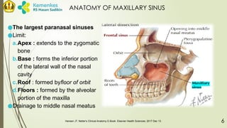 LR - TRAUMA OF MAXILLARY SINUSSSSSS.pptx