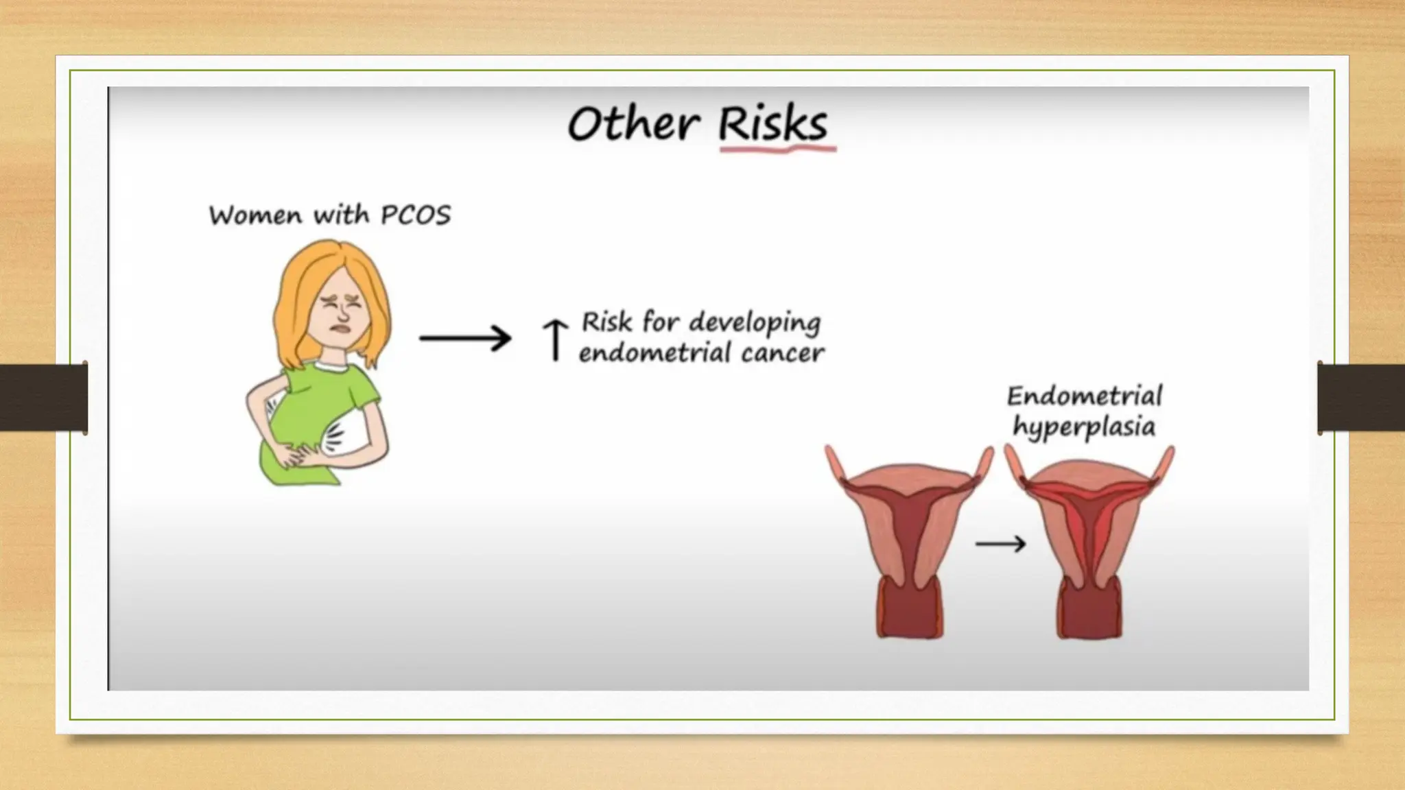 POLY CYSTIC OVARIAN SYNDROME- PATHOPHYSIOLOGY & S/S (OBG) .pptx
