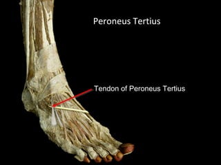 Peroneus Tertius Cadaver