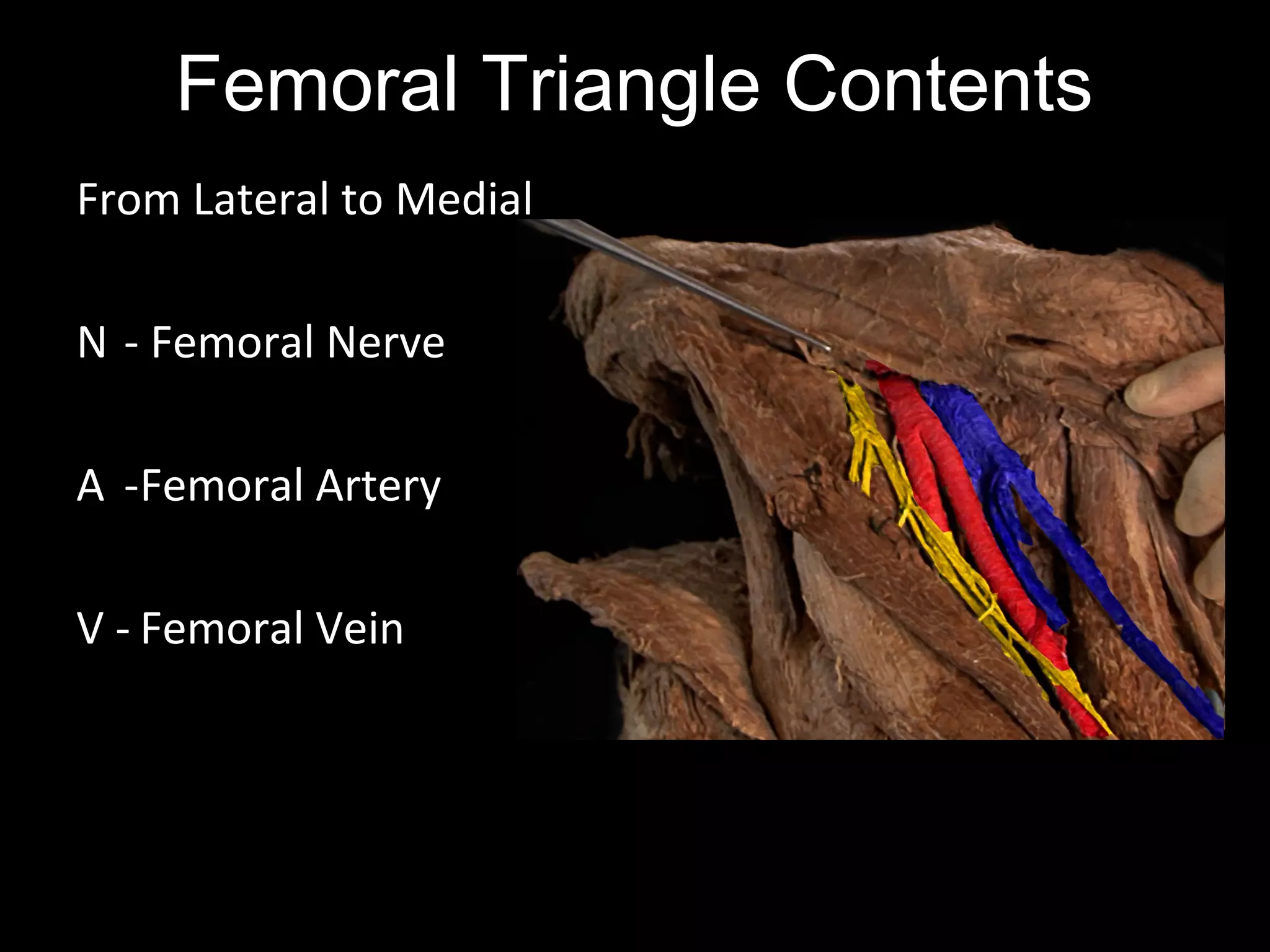 Slideshow: Femoral Triangle | PPT