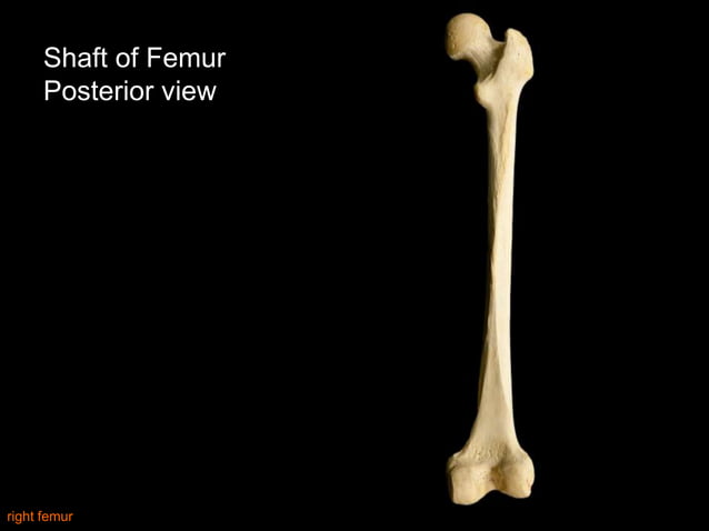 Slideshow: Femur | PPTX