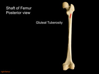 Gluteal Tuberosity Of Femur