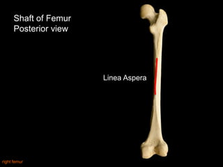 Linea Aspera Of Femur
